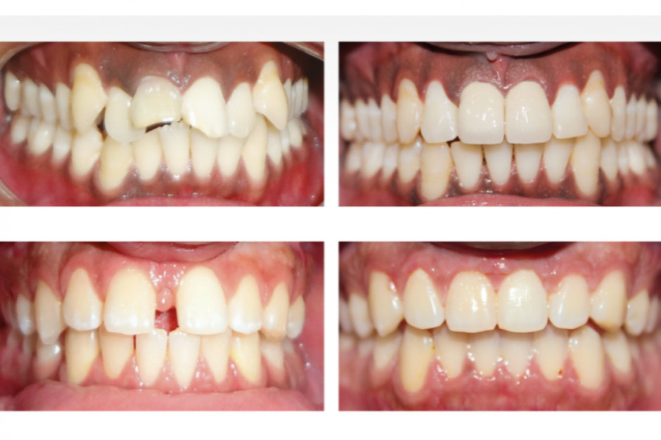 Alignery rosną w siłę