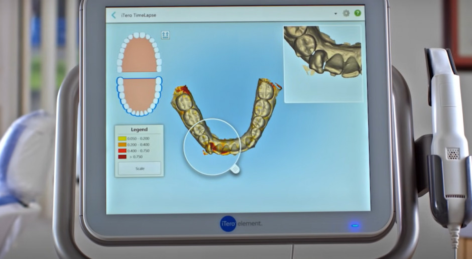 Ważne innowacje na platformie Align Digital Platform