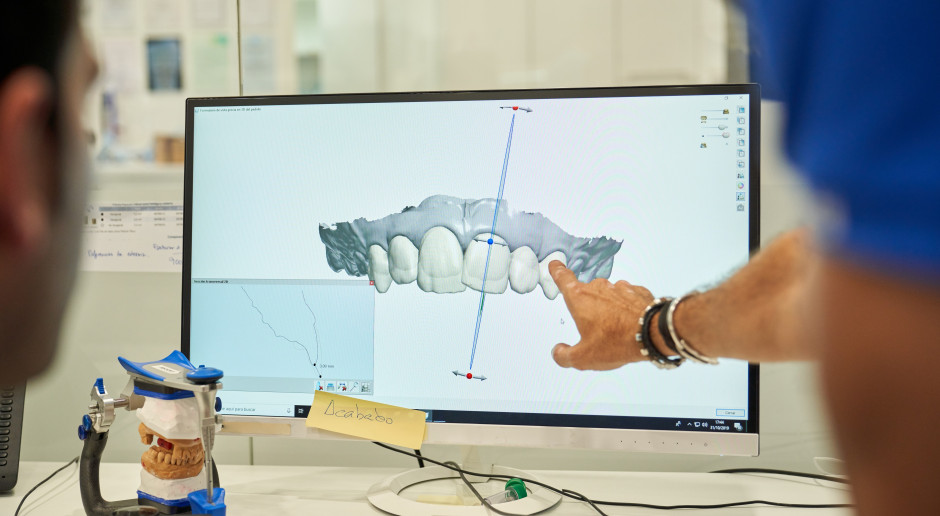 Invisalign Smile Architect mocne wsparcie w leczeniu ortodontyczno ...